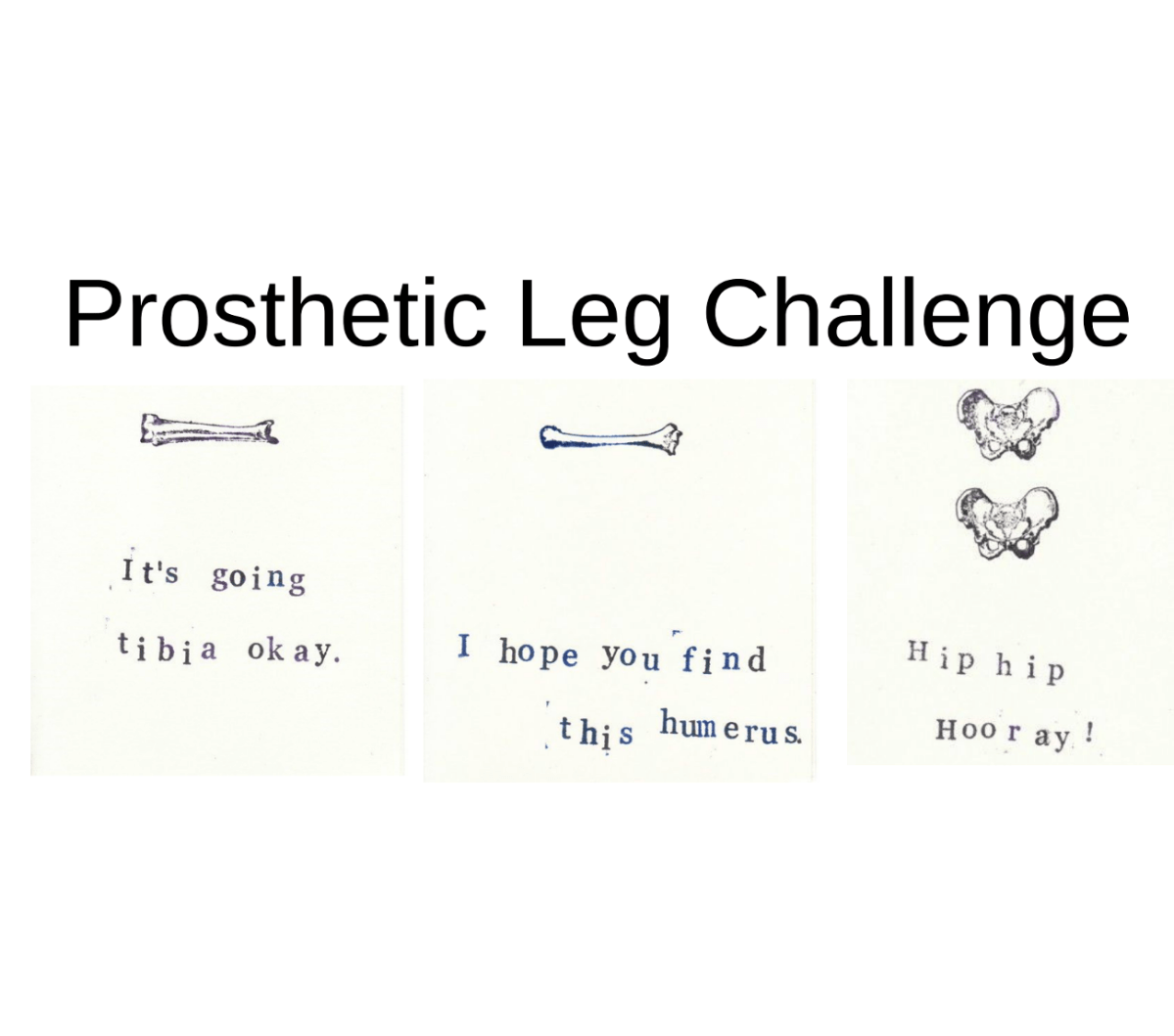 BioMed9 Prosthetic Leg Challenge – STEMIA Journal